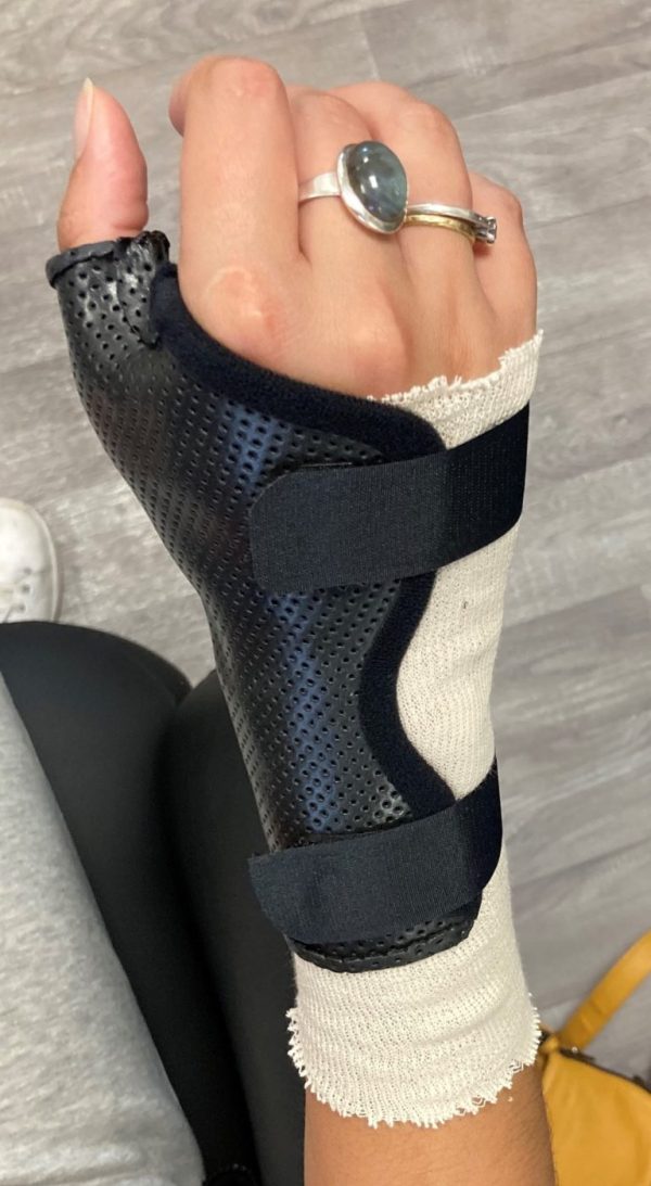 Orthèse main : comment soulager rapidement la douleur