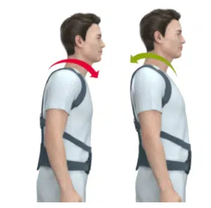 Cyphose : Définition, Symptômes, Causes et Traitements Efficaces