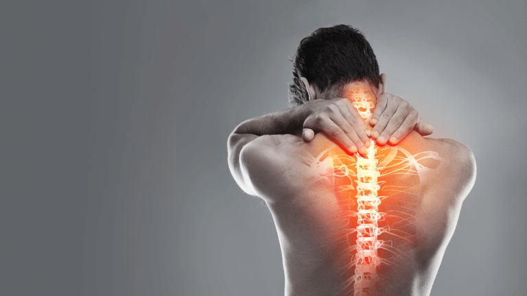 Cyphose : Définition, Symptômes, Causes et Traitements Efficaces