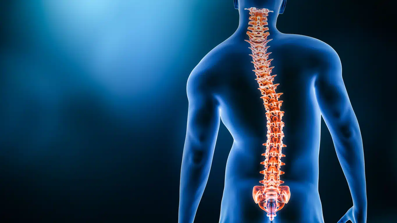 Tassement vertébral : Que signifie cette fracture