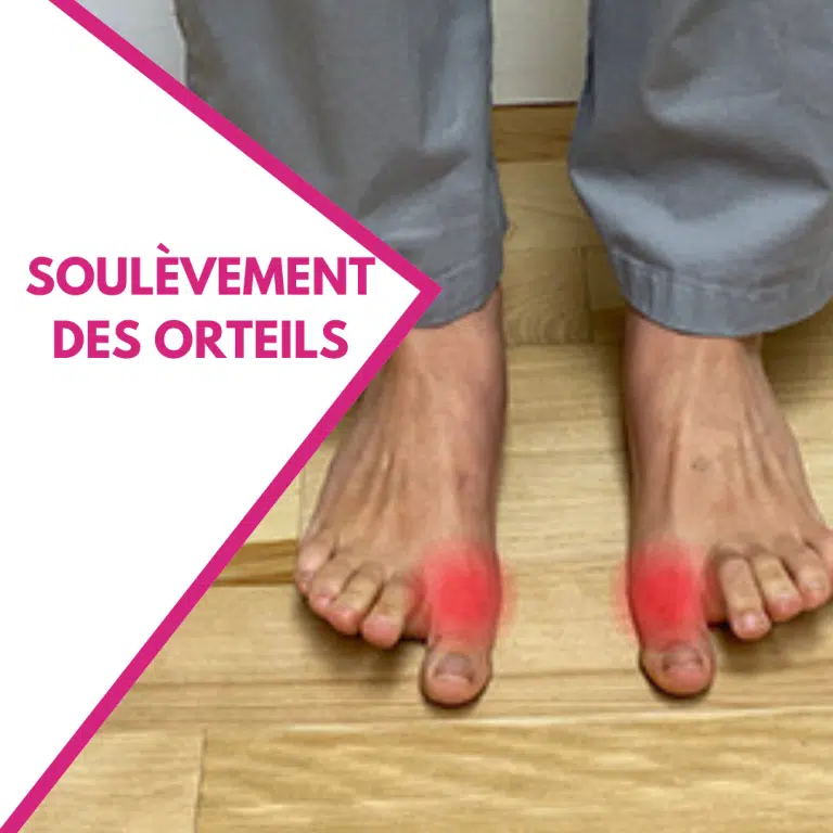 Hallux valgus 5 exercices de renforcement et mobilité